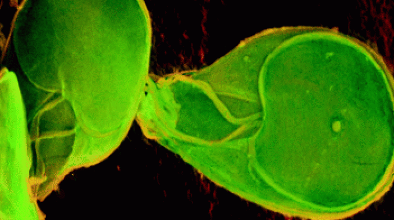 Lamblia (ogoniastek jelitowy, wielkouściec jelitowy,Giardia lamblia ...