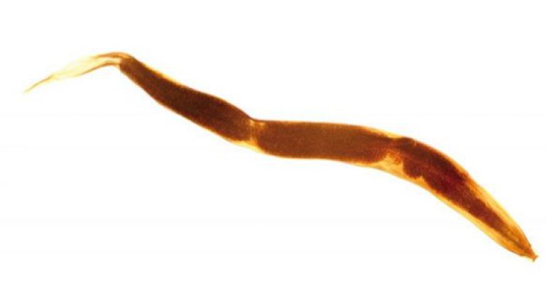 Owsik ludzki (Enterobius vermicularis, rupie, threadworm) - Witaminy i ...